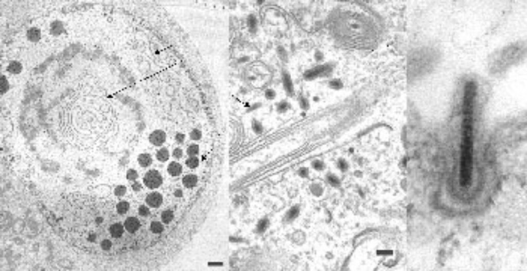 biological control via entomophatogenic viruses: baculovirus ...
